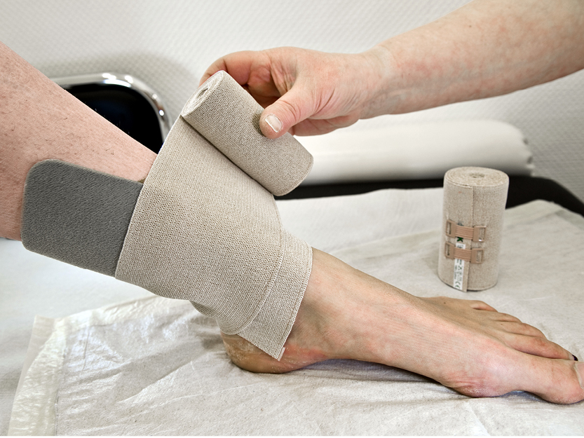 Ulcus cruris I das Wichtigste kurz und verständlich erklärt